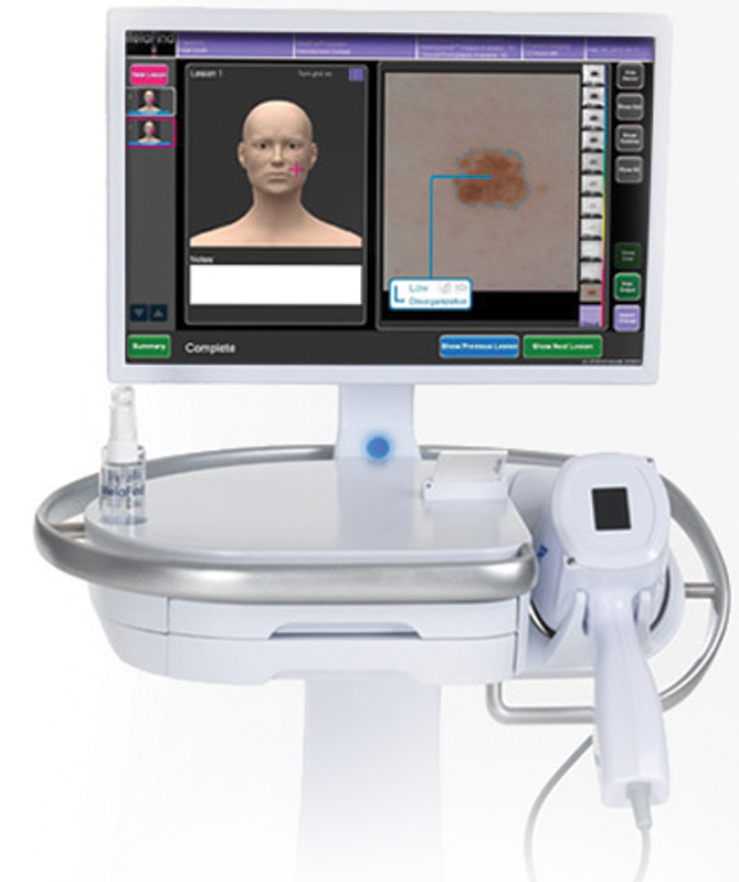 A New Way to Detect Skin Cancer – South Florida Health and Wellness ...