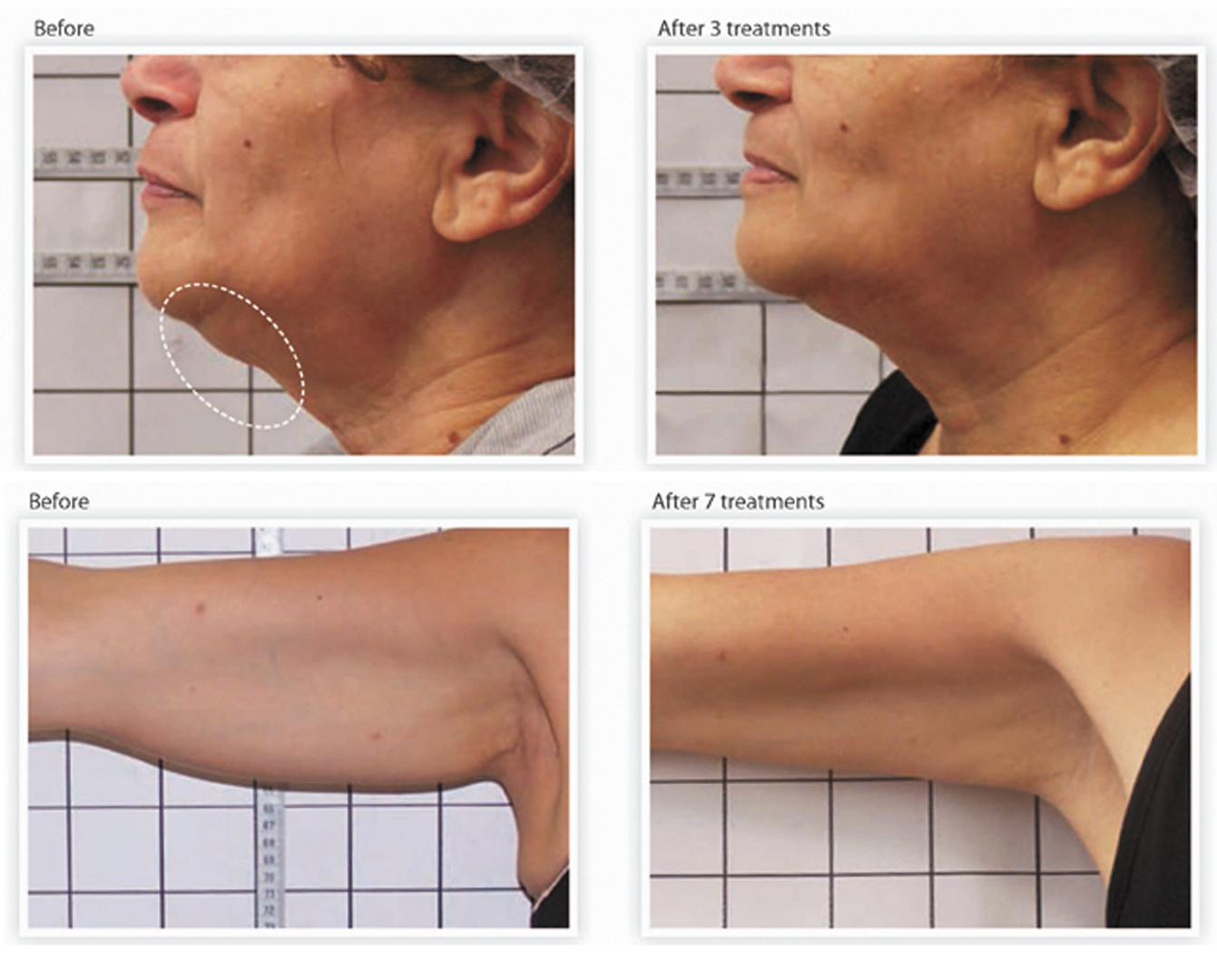 Is Loose and Sagging Skin Plaguing You? – South Florida Health and ...